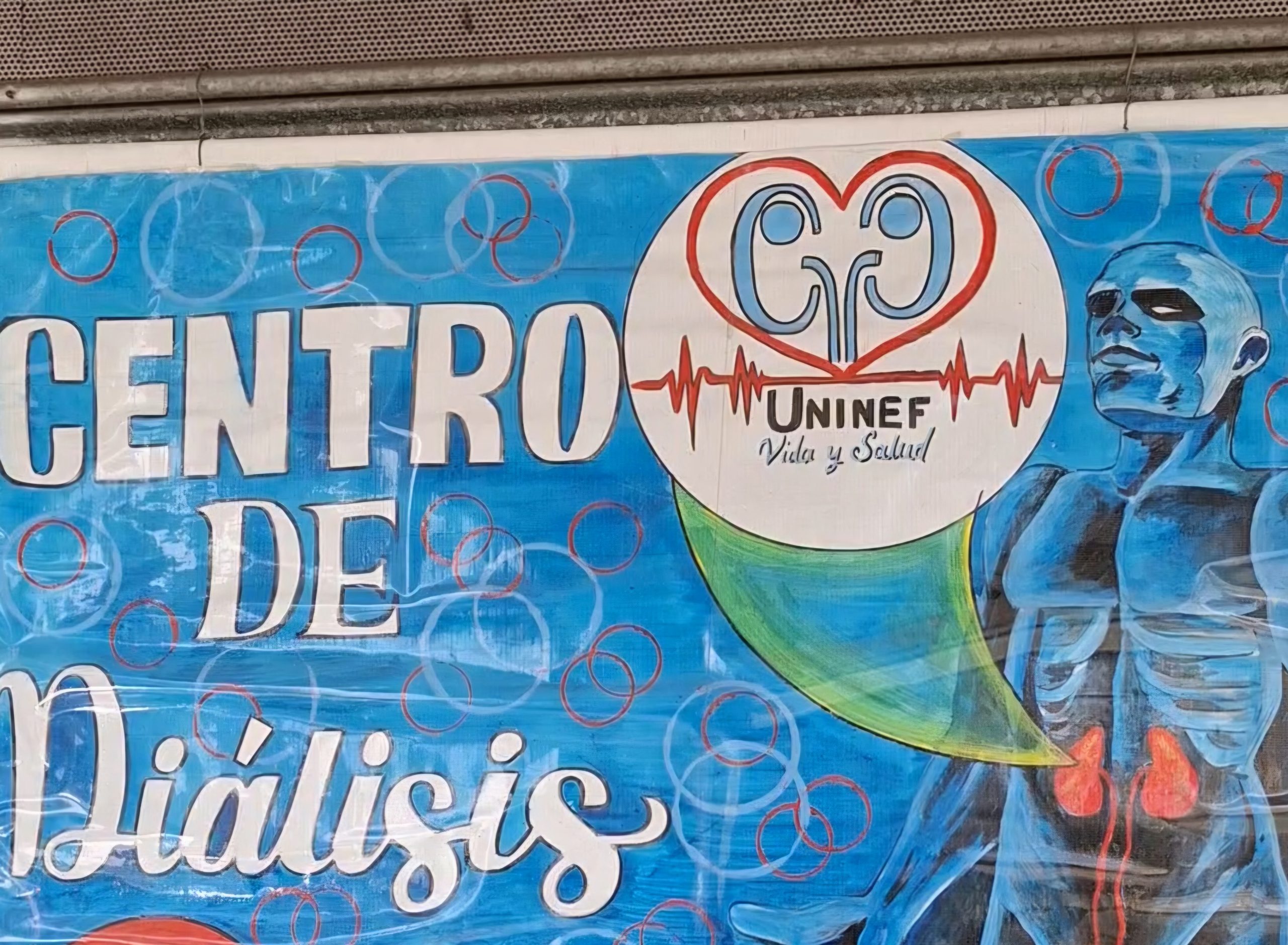 Racionan diálisis de pacientes renales en Puerto Ordaz por falta de equipos